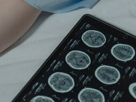 Germánská nová medicína :: vykladanisnu